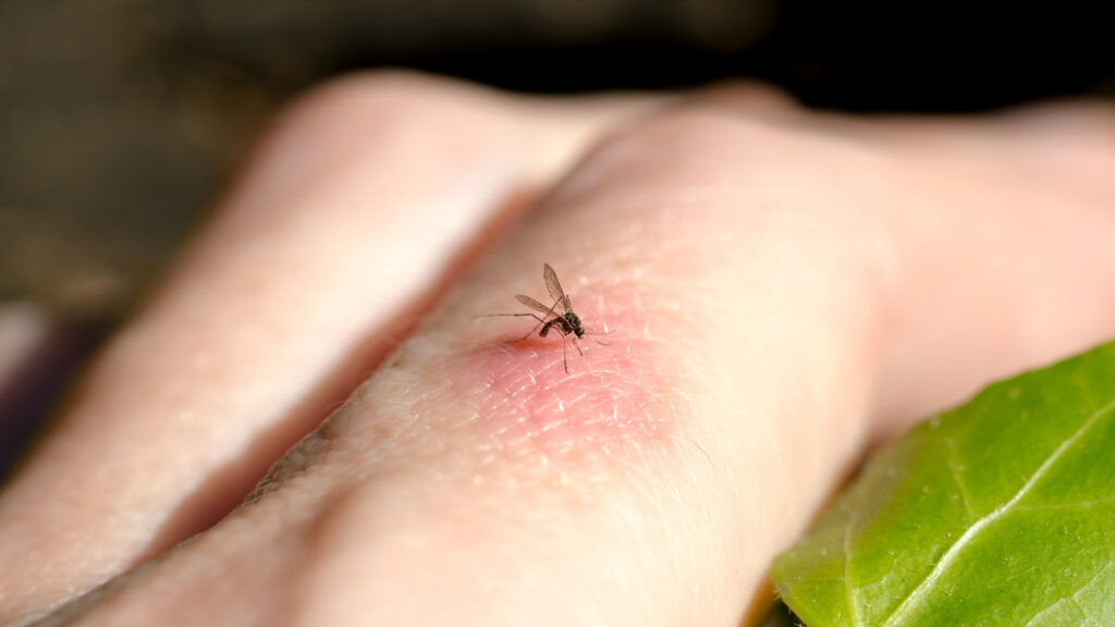 How Do I Stop Mosquitoes From Biting Me? - Mosquito Repellent